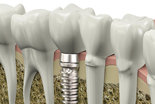 Advanced Technology | Patel Family Dentistry
